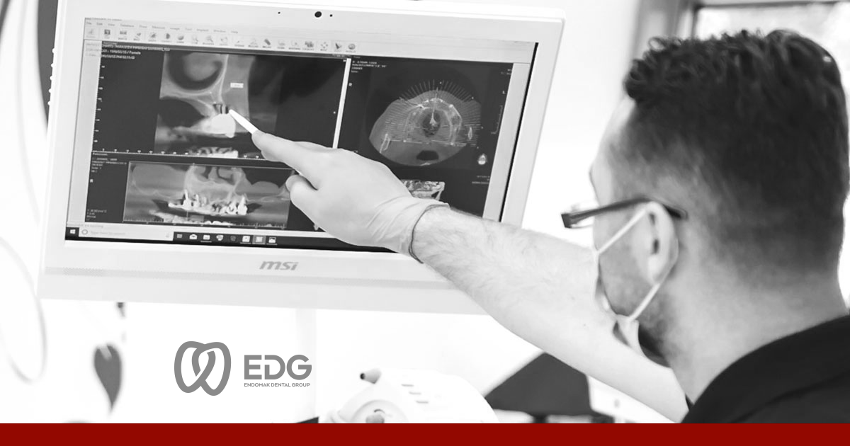ΨΗΦΙΑΚΗΣ ΑΚΤΙΝΟΓΡΑΦΙΑΣ 2D ΚΑΙ 3D CBCT - EDG Dental Clinics & Labs